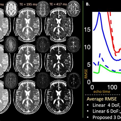 A Exemplar Reconstructed Echo Images Associated Error Maps And B