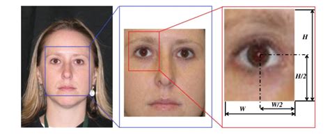 Definition Of The Periocular Region From Left To Right The Original