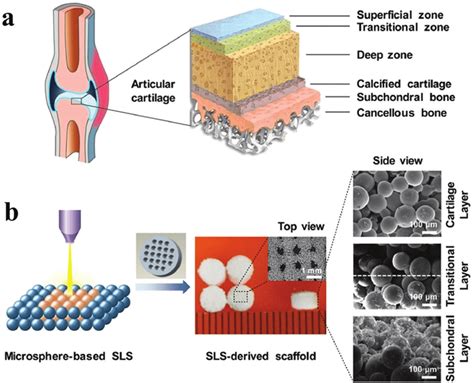 Schematic Of The Hierarchical Architecture Of Natural Osteochondral And