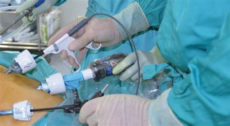 Postgraduate Certificate In Exploratory Laparoscopy And Benign Adnexal