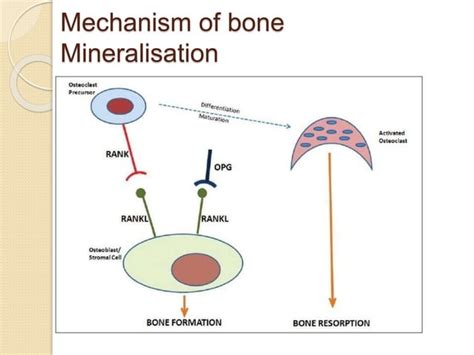 Hypercalcemia Associated With Malignancy Pptm 2 Pptx Endocrine And Metabolic Diseases