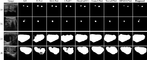 Figure 2 From Dual Stream Assisted U Net For Thyroid Nodule Segmentation Semantic Scholar