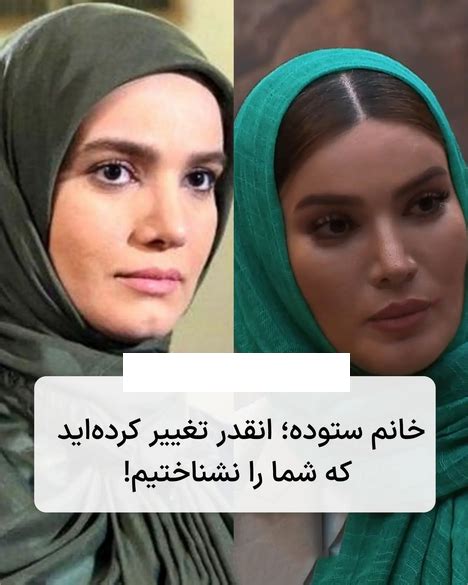 همه عمل های زیبایی متین ستوده تغییر چهره از سریال لیسانسه ها تا جوکر