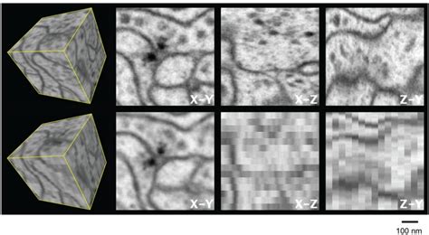Enhanced Fib Sem Systems For Large Volume 3d Imaging Pmc