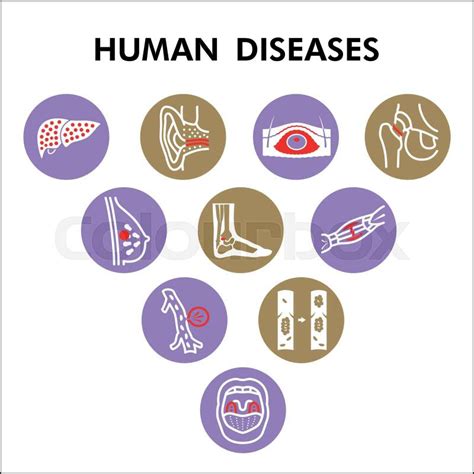 Modern Human Diseases Infographic Design Template With Icons Colourbox