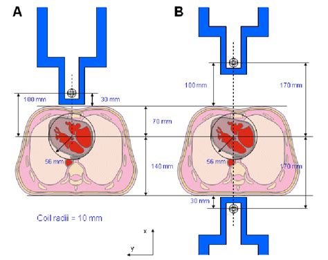 A Asymmetric And B Symmetric Unipositional Lead Systems Download