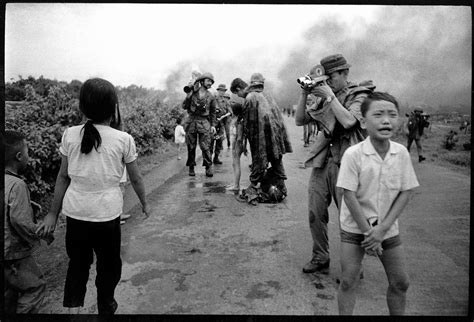 Vietnam War Napalm Victims