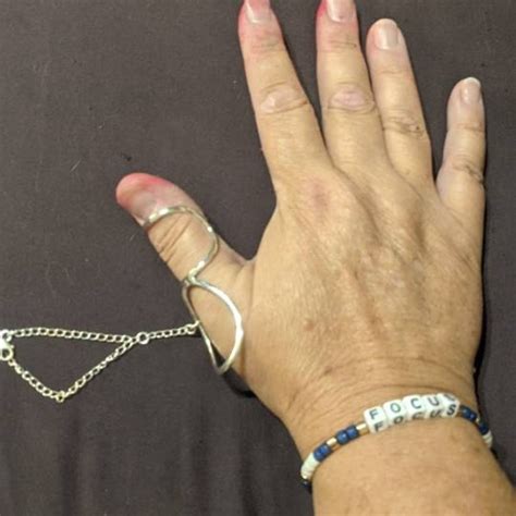 Arthritis Mcp Hyperextension Splint Ringfull Hand Support Splintthumb