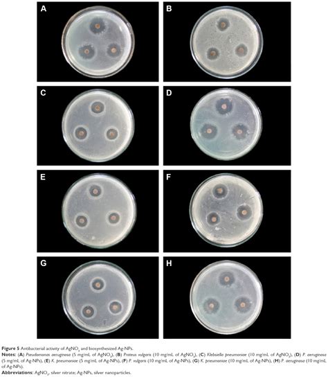 Biosynthesis Characterization And Evaluation Of Bioactivities Of Lea Ijn
