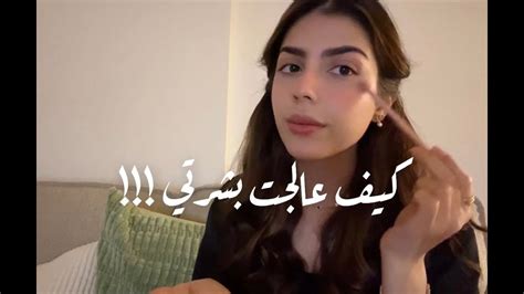 تجربتي مع الروكتان🤩 ، جاوبت اسئلتكم👀 ، ميكب 💕 Youtube