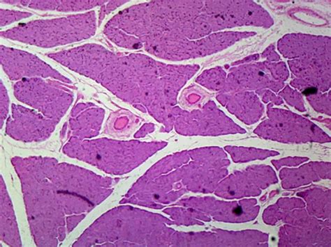 Prepared Microscope Slide Pancreas Mammalian Section Showing Acini Ducts And Islets Of