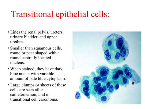 Microscopic Examination Of Urine And Other Special Tests Pptx