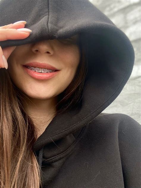 Braces Panosundaki Pin