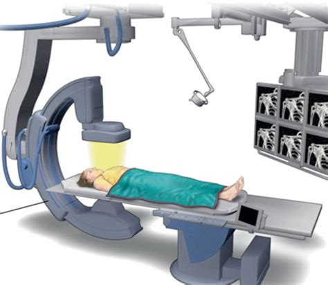 Digital Imaging Flashcards Quizlet