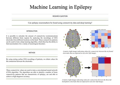 Machine Learning In Epilepsy Computational Neuroscience And Visual Perception Laboratory
