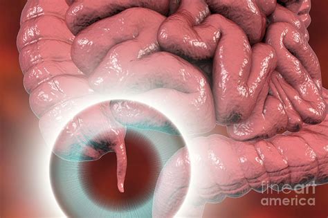 Human Appendix Photograph By Kateryna Kon Science Photo Library Pixels