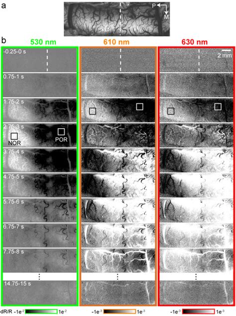 Spatiotemporal Properties Of Cortical Activation By Tces 20 Hz
