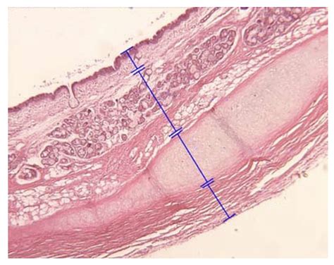Trachea Pathology Diagram Quizlet
