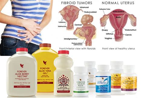 Anterior Uterine Body Fibroid Understanding Symptoms Causes And