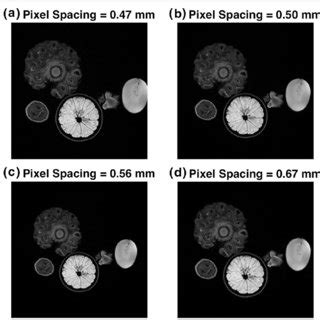 Image Of Small Variation In Pixel Size Achieved By Changes In Download Scientific Diagram