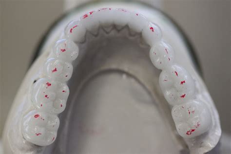 Power Of The Right Bite Gorbatov Dentistry Your Dentist In