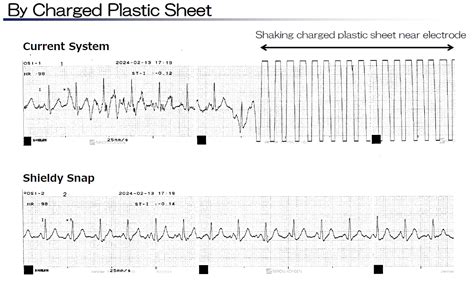 ecg noise reduction health science technologies