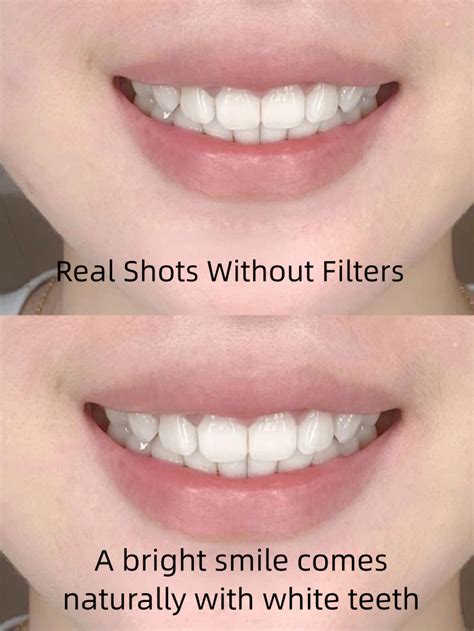 Japanese Teeth Whitening Toothpaste Recycled Silicon Probiotics