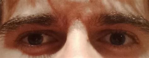 Whats My Eye Shape Taxonomyphenotype Rphenotypes