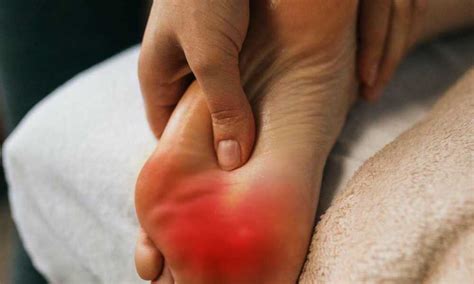 Sindroma E Djegies Së Këmbëve çfarë është Revista Psikologji