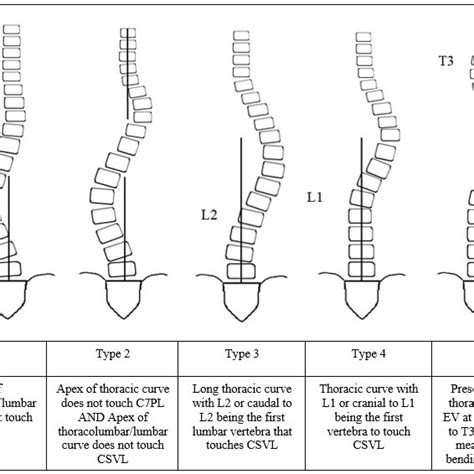 Clinical Examples Of The Different Curve Types 1 5 Download Scientific Diagram