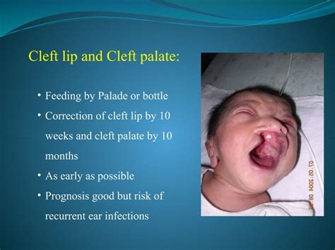 Common Neonatal Problempptxewrglugriulg Pptx Pregnancy