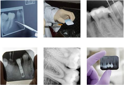 Dental Xray Film Imaging Processor Darkroom Portable Developer For Per