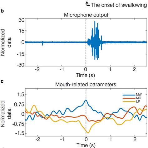 Representative Waveforms Of Participant 1 These Waveforms Were Traced