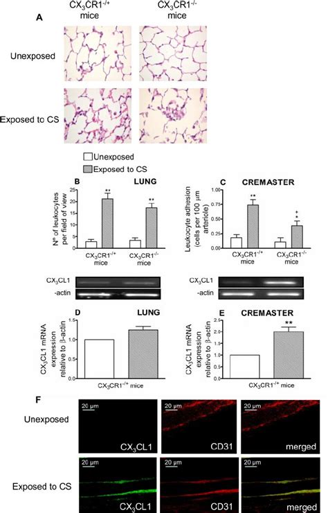 Cigarette Smoke Cs Exposure Induces Lung In Fl Ammation A And B Download Scientific