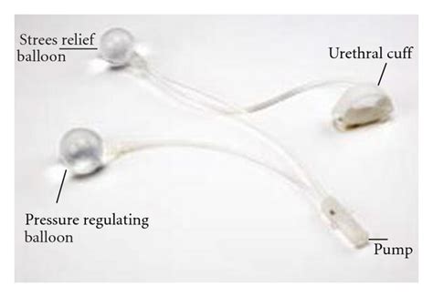 Flowsecure Artificial Urinary Sphincter Download Scientific Diagram