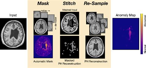 Mask Stitch And Re Sample Enhancing Robustness And Generalizability In Anomaly Detection