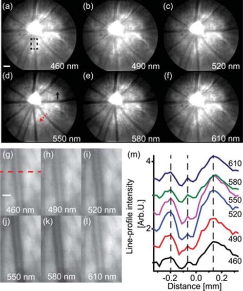 Snapshot Hyperspectral Retinal Imaging Using Compact Spectral Resolving
