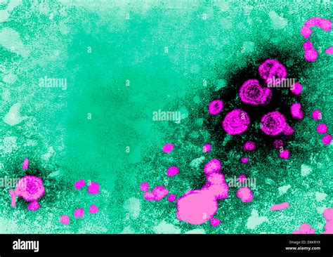 This Digitally Colorized Transmission Electron Micrograph Tem
