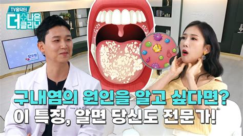 입 안의 비밀 전쟁 구강건조증과 구내염 잡는법 Youtube
