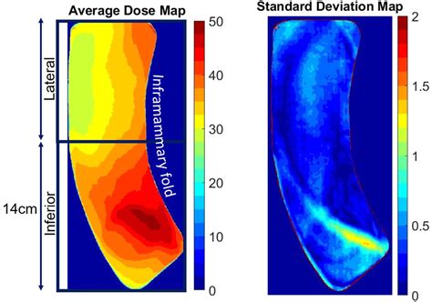Toward A Skin Dose Area Metric Predictive Of Moist Desquamation Using In Vivo Skin Dosimetry And