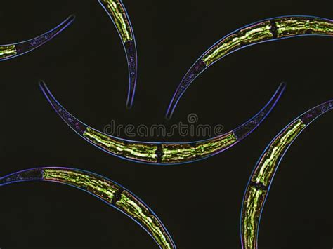 Closterium Sp Charophyta Algae Under Microscopic View X40 Green Algae Dark Background Stock