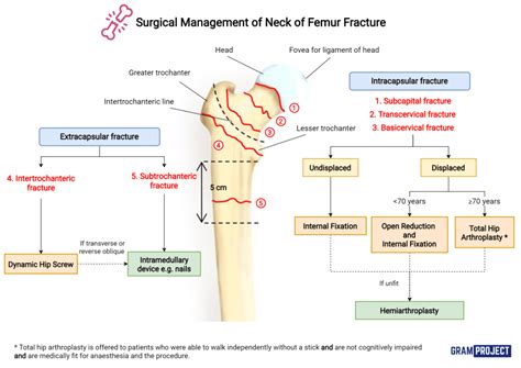Overview Of Classification And Surgical Management Of