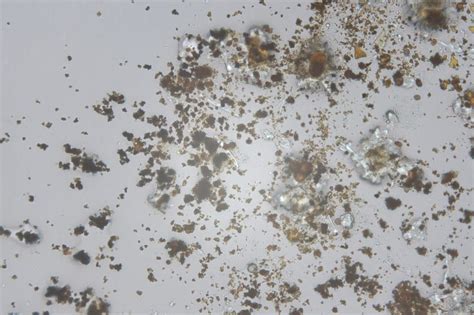 Particle Identification Analysis By Optical Microscopy Sesalab