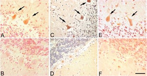 Expression Of Cell Cycle Proteins In The Cerebellar Purkinje Cells Of