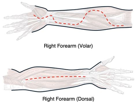 Upper Extremity Fasciotomy Trauma Icu