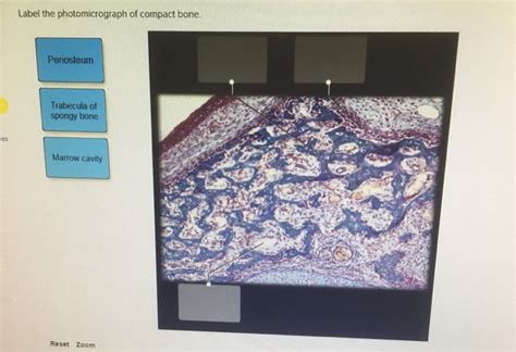 Solved Label The Photomicrograph Of Compact Bone Periosteum