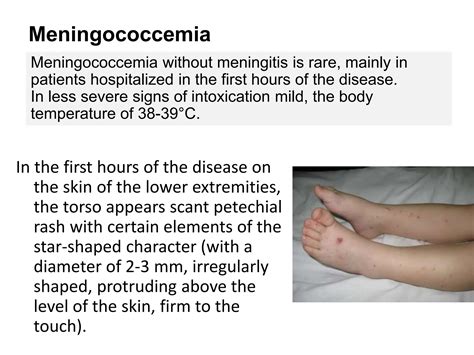 Meningococcal Diseaseосн For Students Ppt Ppt