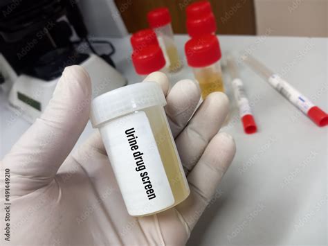 Tab Technician Holds Urine Drug Screen Test Sample Also Known As A