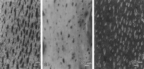 A C Transverse Sections Of Tubules Showing Them As Regular Arrays Of