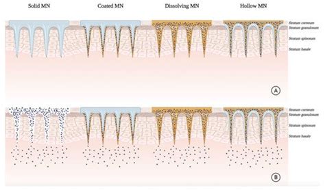 Nano Based Transdermal Delivery Systems Encyclopedia Mdpi